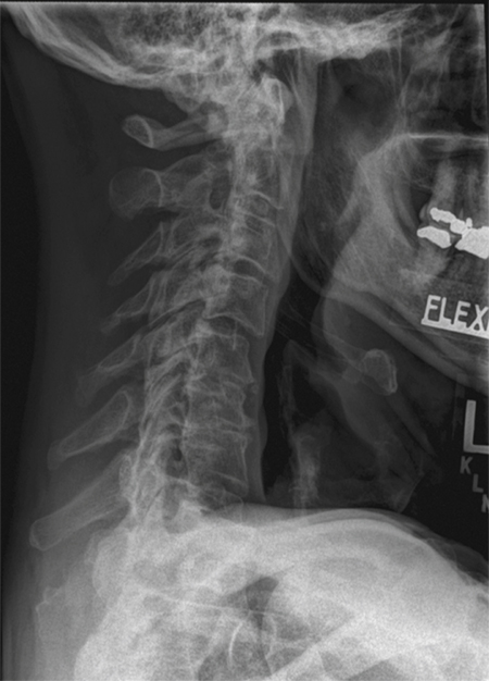 Bontrager's Textbook of Radiographic Positioning and Related Anatomy