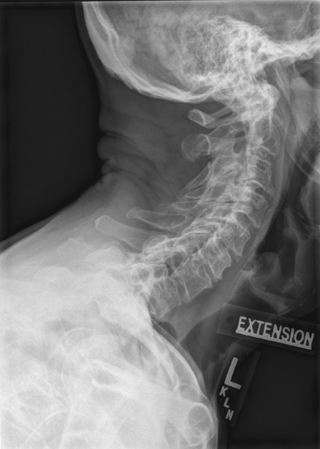 Bontrager's Textbook of Radiographic Positioning and Related Anatomy