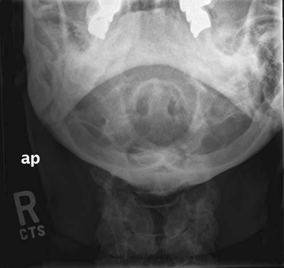 Bontrager's Textbook of Radiographic Positioning and Related Anatomy