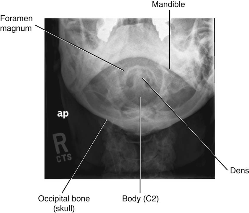 Bontrager's Textbook of Radiographic Positioning and Related Anatomy