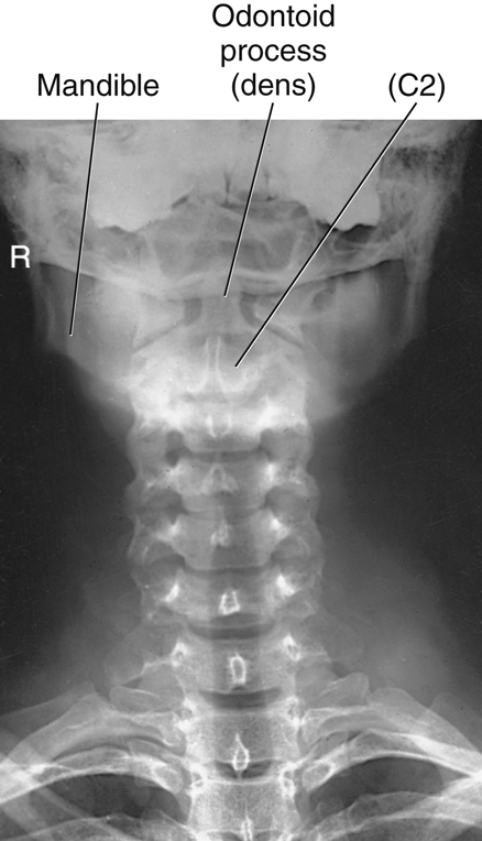 Bontrager's Textbook of Radiographic Positioning and Related Anatomy