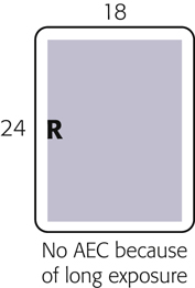 Bontrager's Textbook of Radiographic Positioning and Related Anatomy