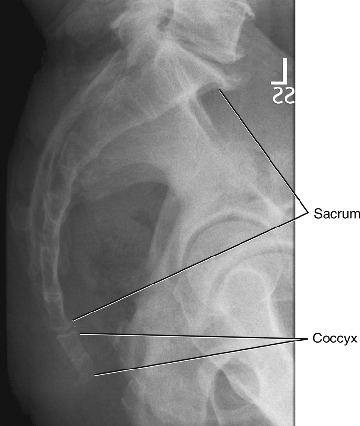 Bontrager's Textbook of Radiographic Positioning and Related Anatomy