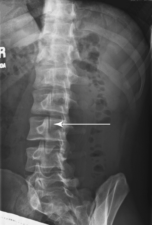 Bontrager's Textbook of Radiographic Positioning and Related Anatomy