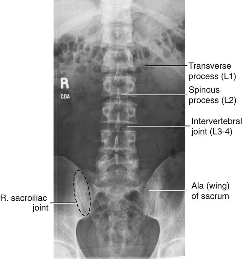 Bontrager's Textbook of Radiographic Positioning and Related Anatomy