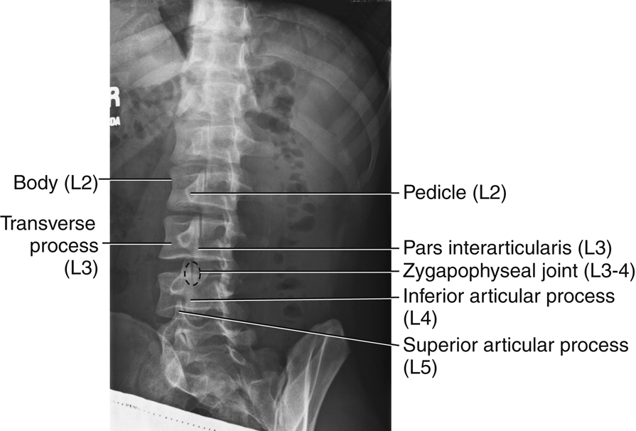 Bontrager's Textbook of Radiographic Positioning and Related Anatomy