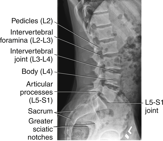 Bontrager's Textbook of Radiographic Positioning and Related Anatomy