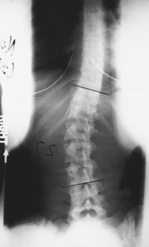 Bontrager's Textbook of Radiographic Positioning and Related Anatomy