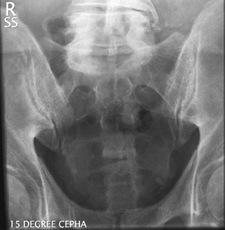 Bontrager's Textbook of Radiographic Positioning and Related Anatomy