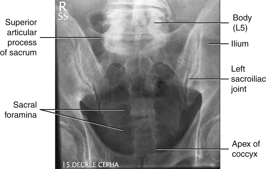 Bontrager's Textbook of Radiographic Positioning and Related Anatomy