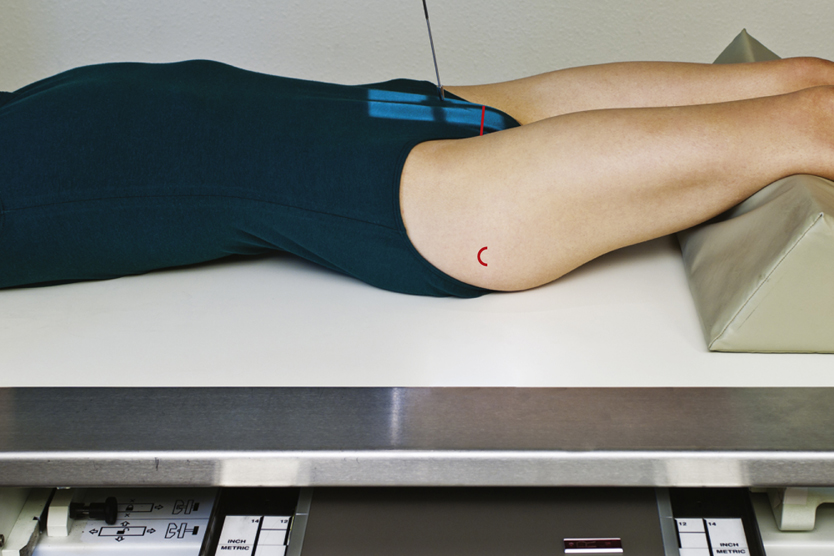 Bontrager's Textbook of Radiographic Positioning and Related Anatomy