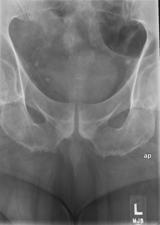 Bontrager's Textbook of Radiographic Positioning and Related Anatomy