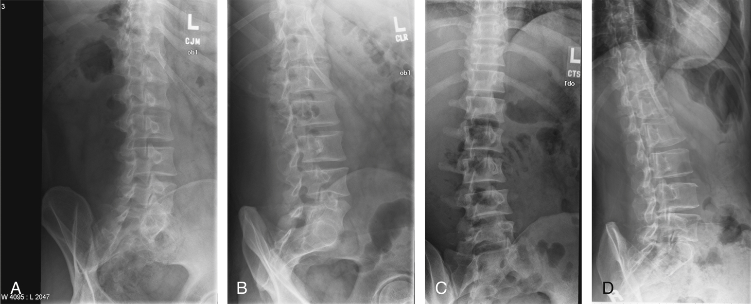 Bontrager's Textbook of Radiographic Positioning and Related Anatomy