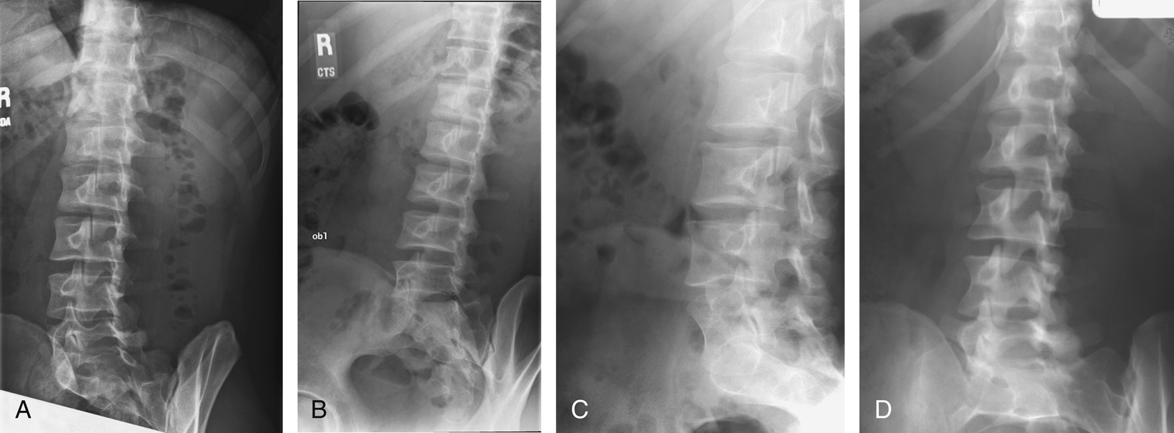 Bontrager's Textbook of Radiographic Positioning and Related Anatomy