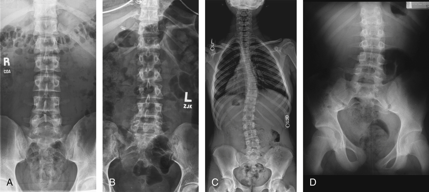 Bontrager's Textbook of Radiographic Positioning and Related Anatomy