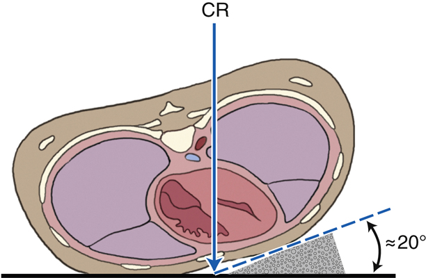 Bontrager's Textbook of Radiographic Positioning and Related Anatomy