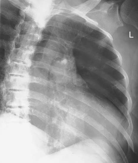 Bontrager's Textbook of Radiographic Positioning and Related Anatomy
