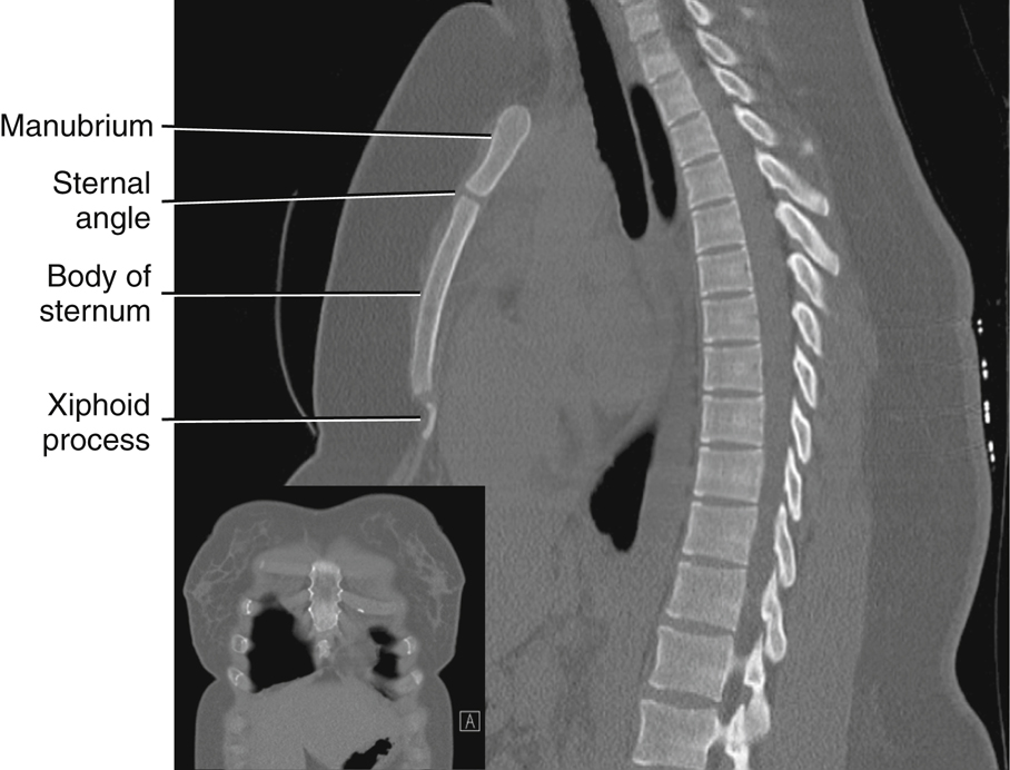 Bontrager's Textbook of Radiographic Positioning and Related Anatomy