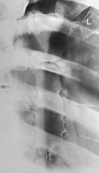 Bontrager's Textbook of Radiographic Positioning and Related Anatomy