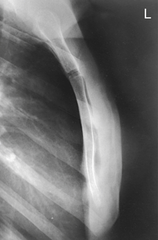 Bontrager's Textbook of Radiographic Positioning and Related Anatomy