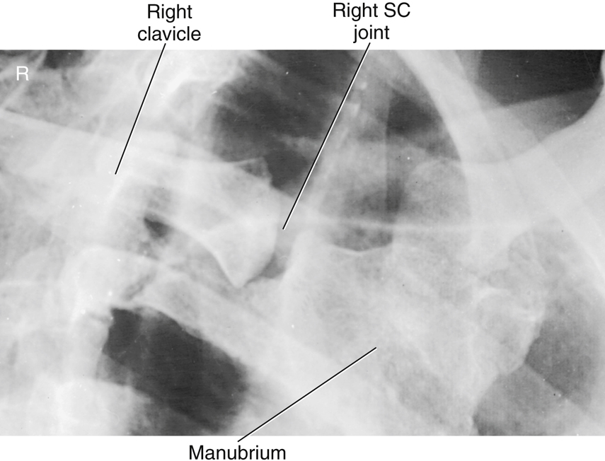 Bontrager's Textbook of Radiographic Positioning and Related Anatomy