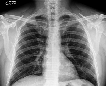 Bontrager's Textbook of Radiographic Positioning and Related Anatomy