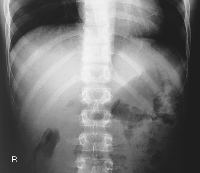 Bontrager's Textbook of Radiographic Positioning and Related Anatomy