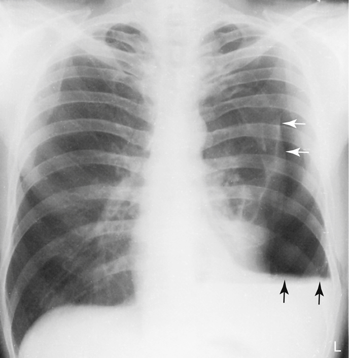 Bontrager's Textbook of Radiographic Positioning and Related Anatomy