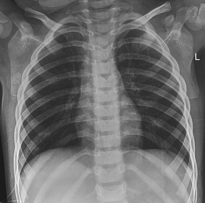 Bontrager's Textbook of Radiographic Positioning and Related Anatomy