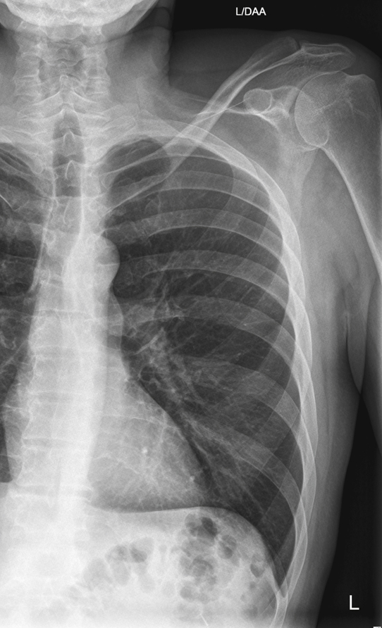 Bontrager's Textbook of Radiographic Positioning and Related Anatomy