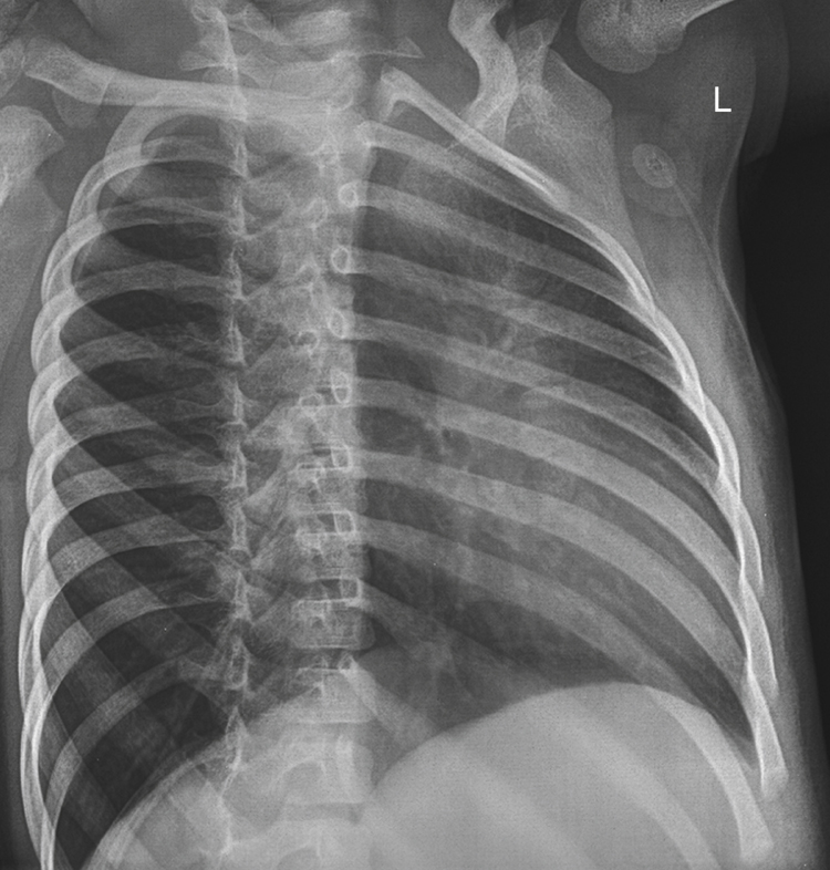 Bontrager's Textbook of Radiographic Positioning and Related Anatomy