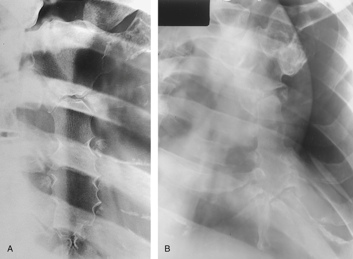 Bontrager's Textbook of Radiographic Positioning and Related Anatomy