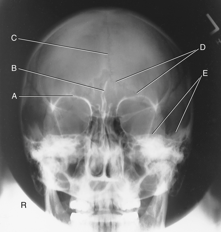 Bontrager's Textbook of Radiographic Positioning and Related Anatomy