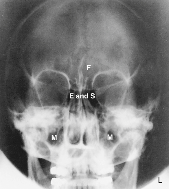 Bontrager's Textbook of Radiographic Positioning and Related Anatomy