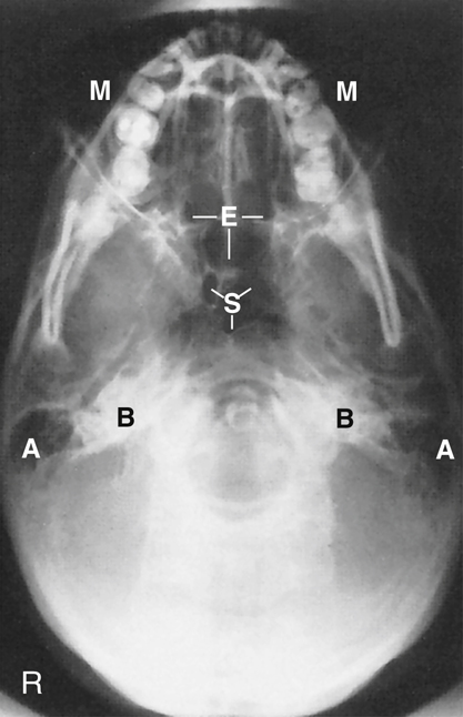 Bontrager's Textbook of Radiographic Positioning and Related Anatomy