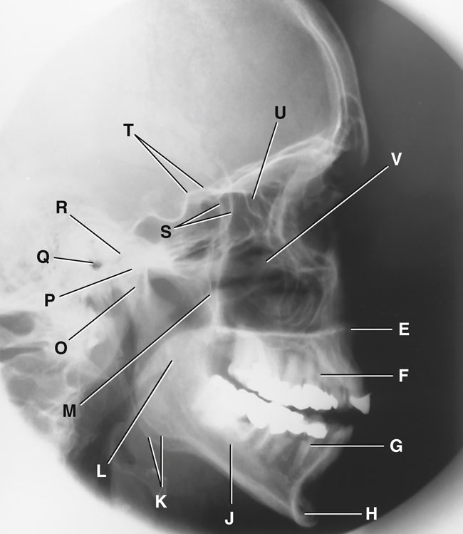 Bontrager's Textbook of Radiographic Positioning and Related Anatomy