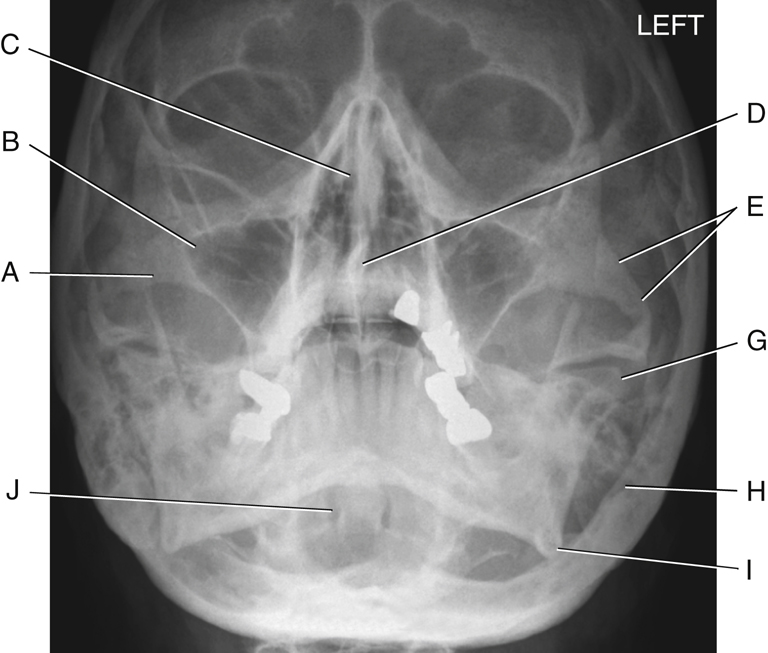 Bontrager's Textbook of Radiographic Positioning and Related Anatomy