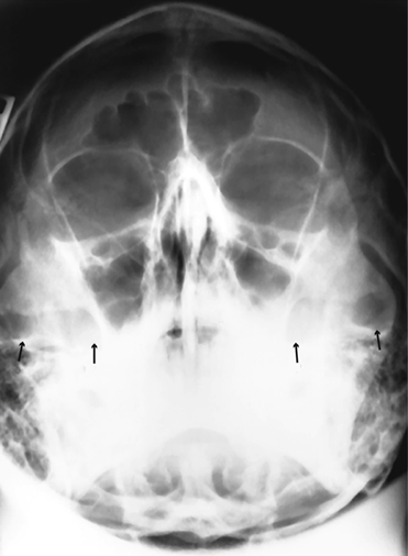 Bontrager's Textbook of Radiographic Positioning and Related Anatomy