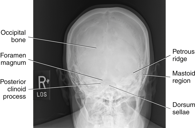 Bontrager's Textbook of Radiographic Positioning and Related Anatomy
