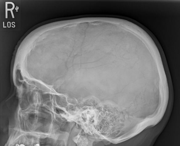 Bontrager's Textbook of Radiographic Positioning and Related Anatomy