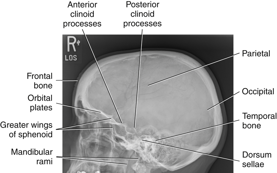 Bontrager's Textbook of Radiographic Positioning and Related Anatomy