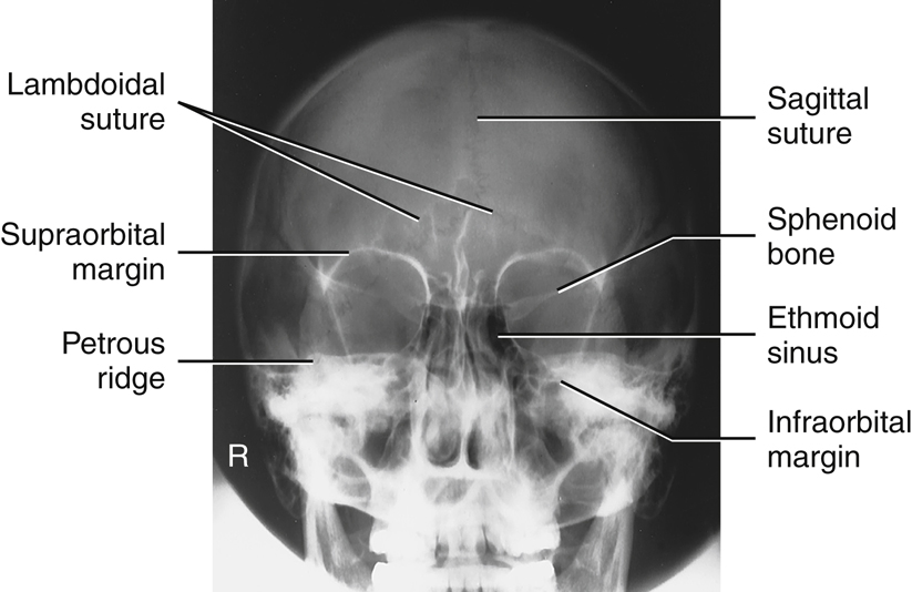 Bontrager's Textbook of Radiographic Positioning and Related Anatomy