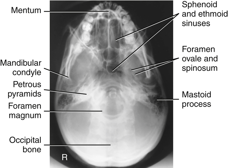 Bontrager's Textbook of Radiographic Positioning and Related Anatomy