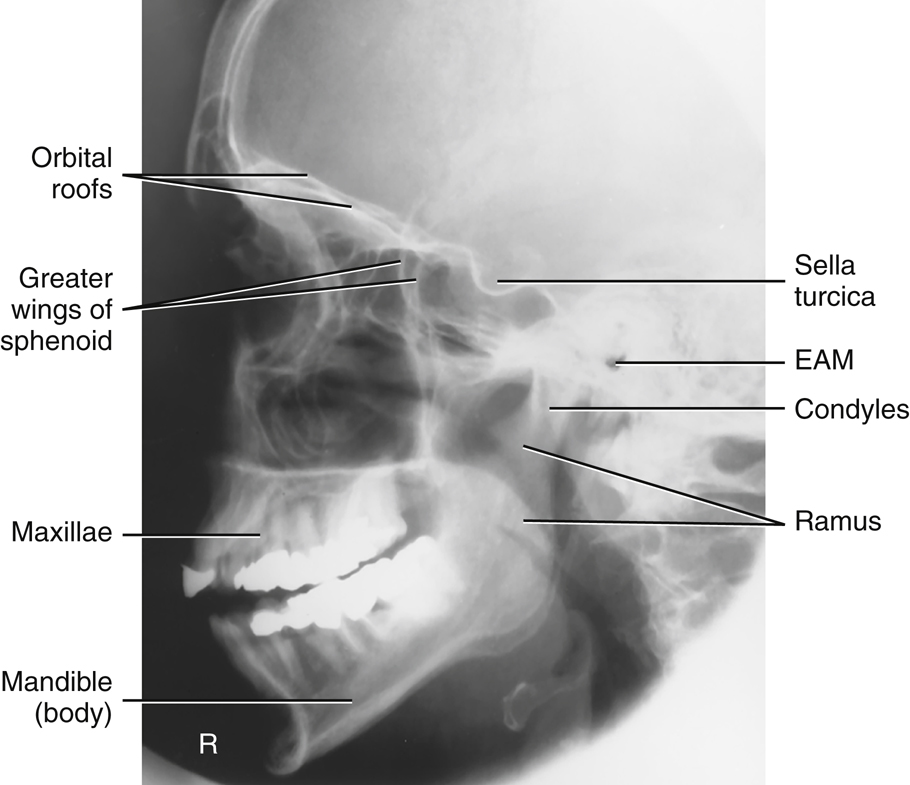 Bontrager's Textbook of Radiographic Positioning and Related Anatomy