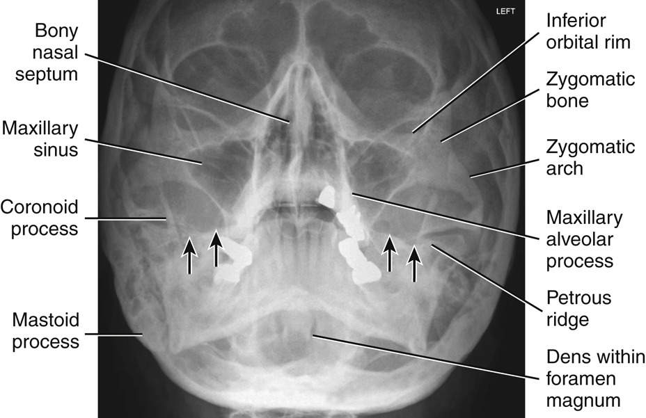 Bontrager's Textbook of Radiographic Positioning and Related Anatomy