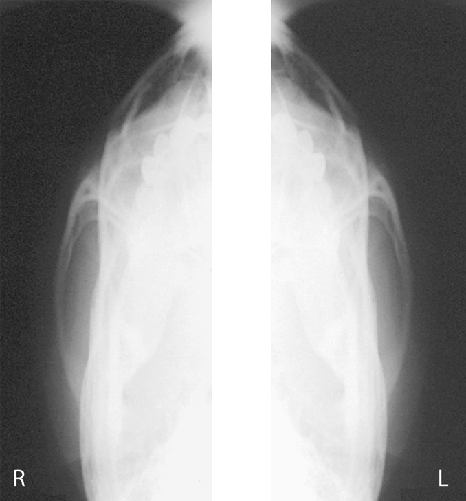 Bontrager's Textbook of Radiographic Positioning and Related Anatomy