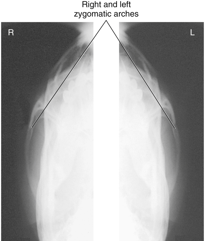 Bontrager's Textbook of Radiographic Positioning and Related Anatomy