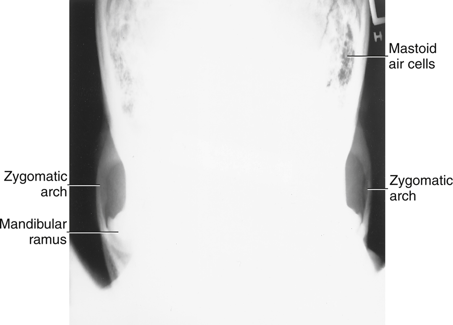 Bontrager's Textbook of Radiographic Positioning and Related Anatomy