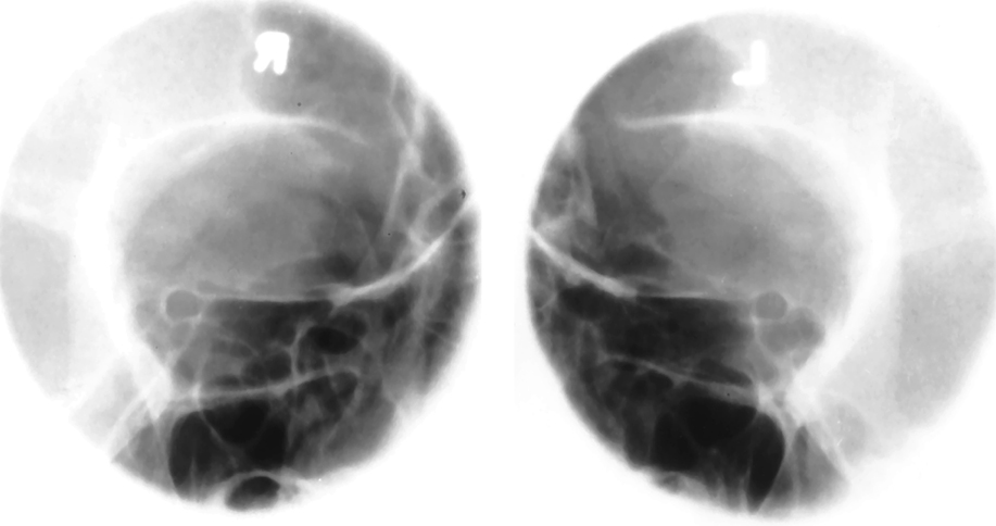 Bontrager's Textbook of Radiographic Positioning and Related Anatomy