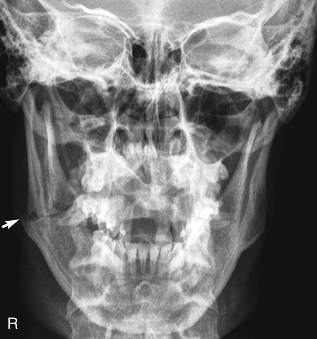 Bontrager's Textbook of Radiographic Positioning and Related Anatomy